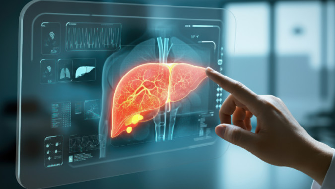 Managing MASH Without Invasiveness: An Interactive Case Challenge| myCME