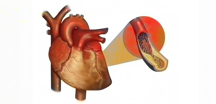 Free Online CME and CE Courses from NACE