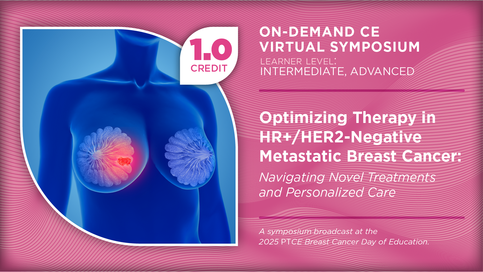 Optimizing Therapy in HR+/HER2-Negative Metastatic Breast Cancer ...
